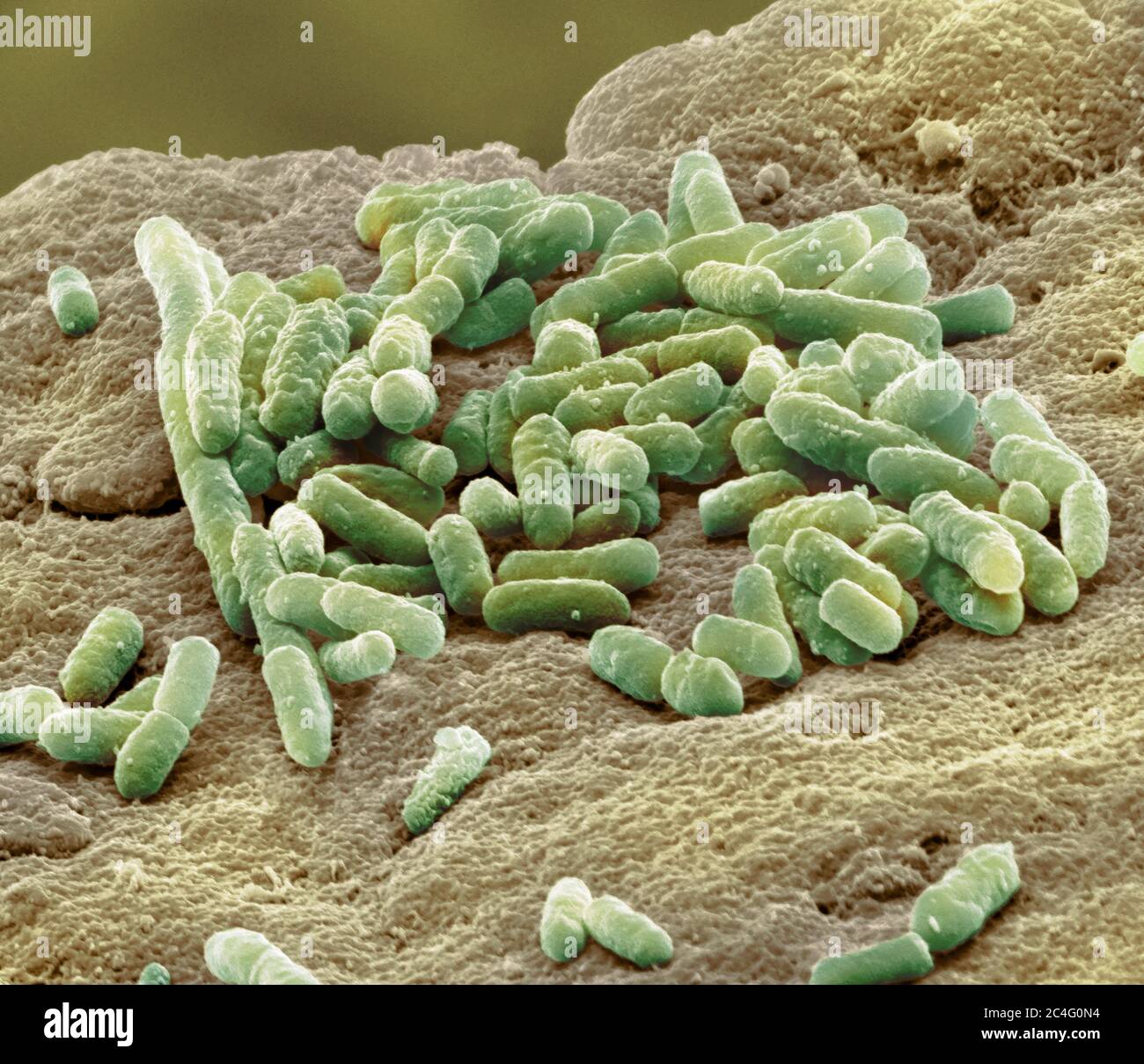 Coloured scanning electron micrograph of the rod-shaped, Gram-negative ...