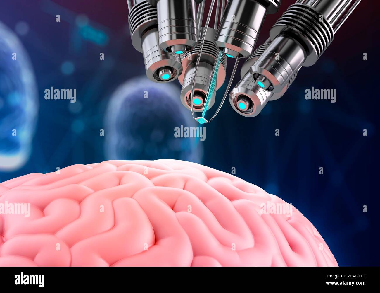 Implanting chip in human brain, illustration Stock Photo - Alamy