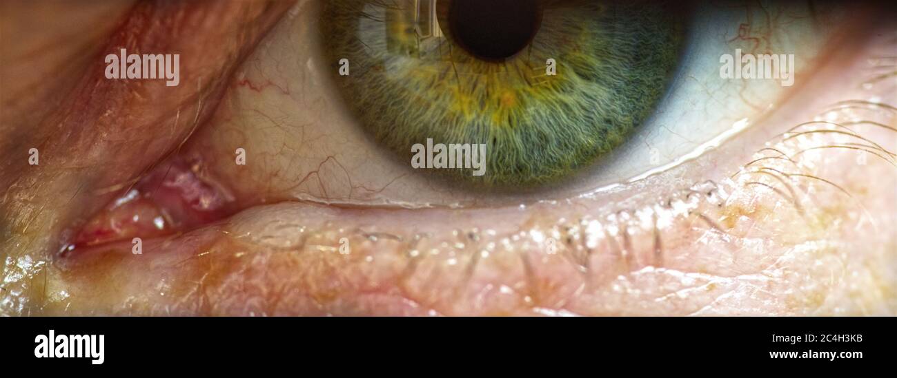 Hazel eye hi-res stock photography and images - Alamy