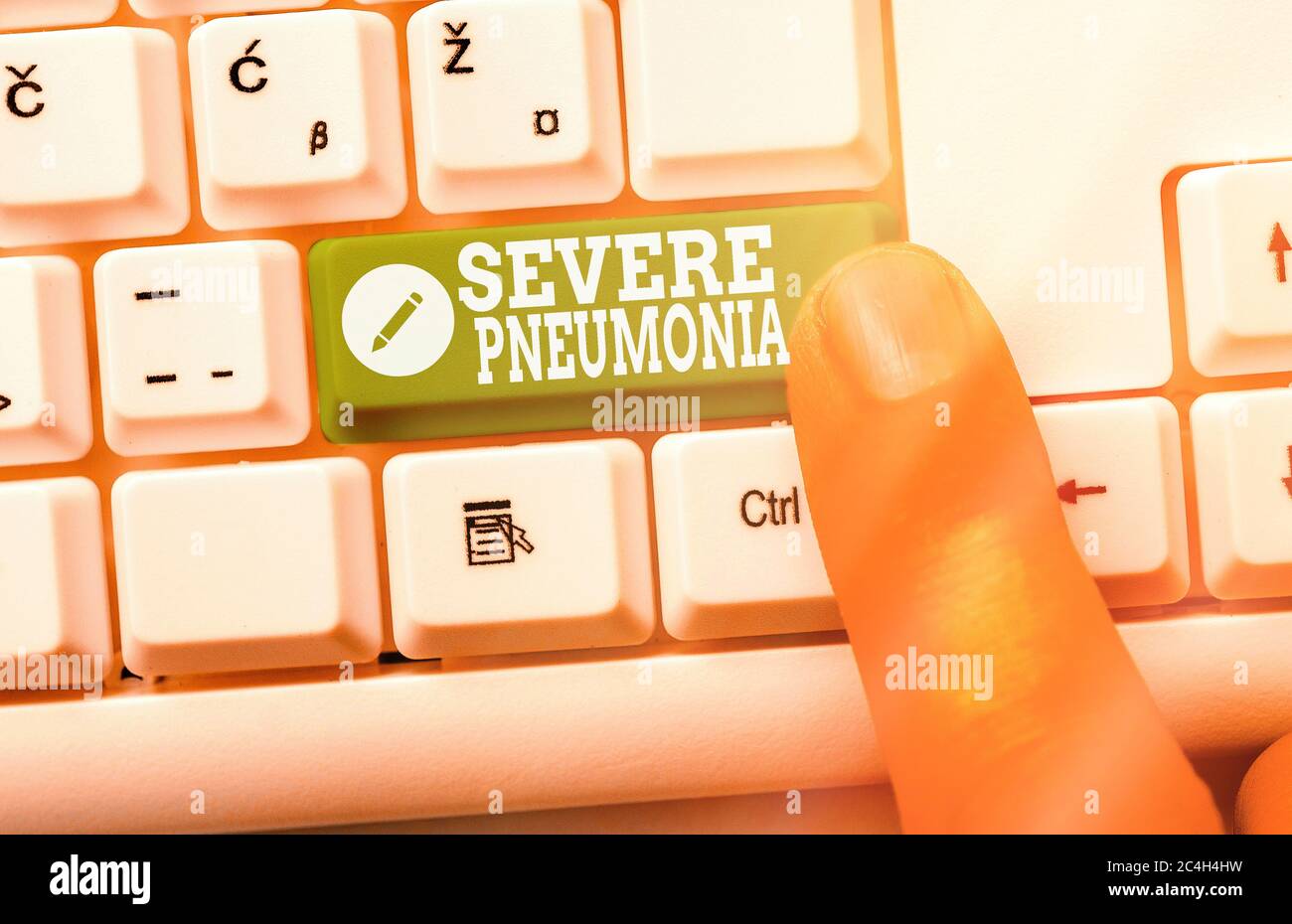 Handwriting text Severe Pneumonia. Conceptual photo acute disease that ...