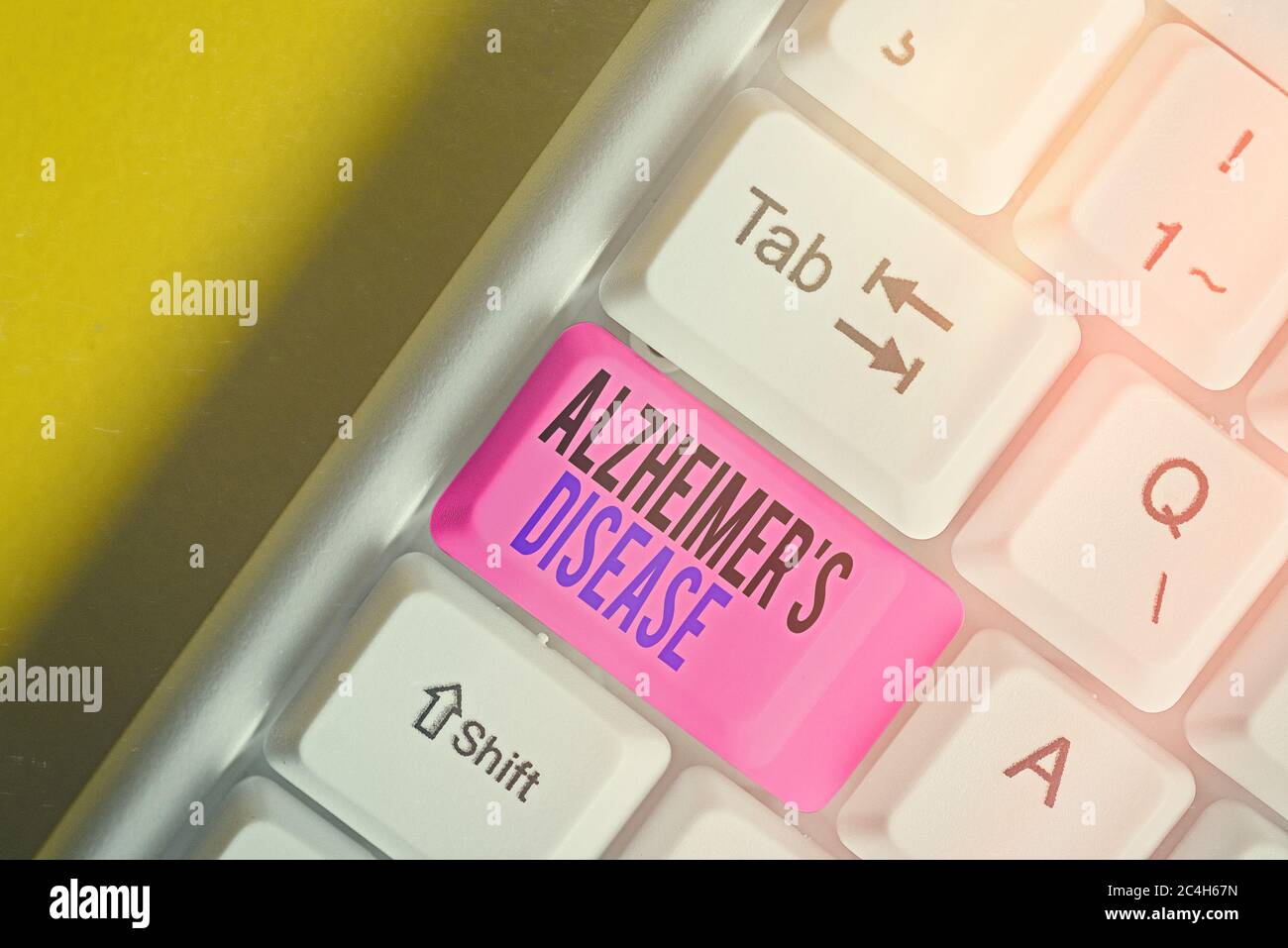 Writing note showing Alzheimers Disease. Business concept for ...