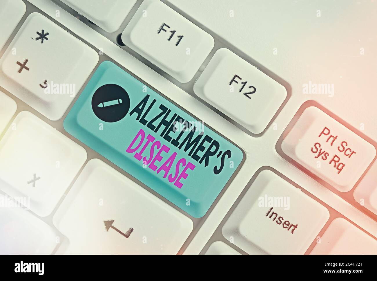 Conceptual hand writing showing Alzheimers Disease. Concept meaning ...