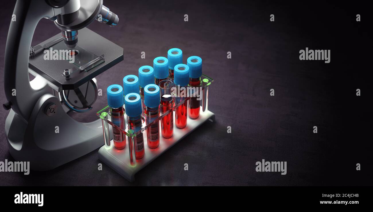 Blood test samples tubes and microscope on black background. Healthcare ...
