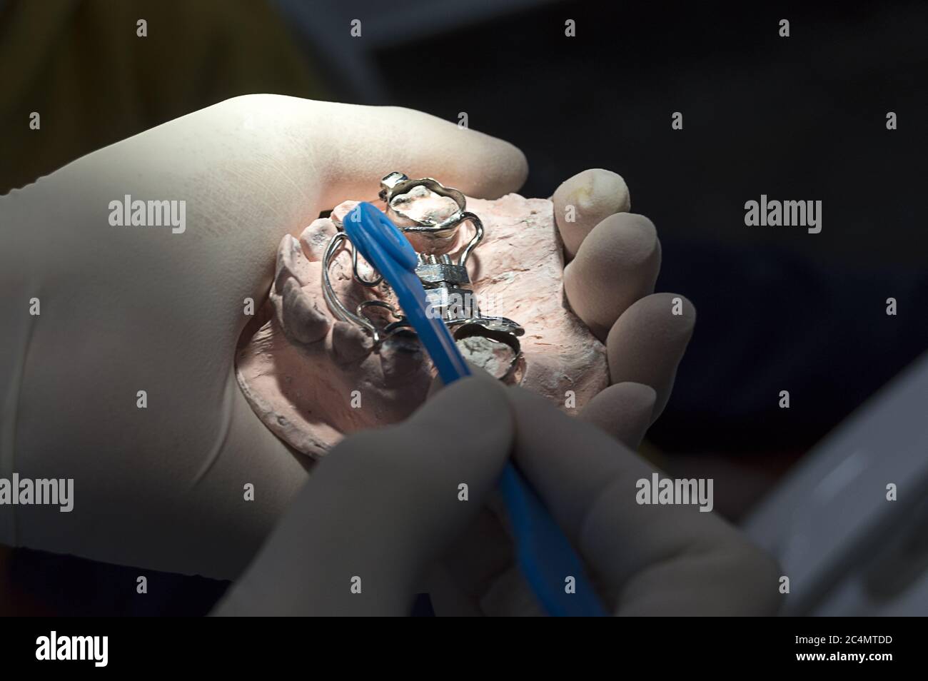 Orthodontic expander detail held by the dentist's hands Stock Photo - Alamy
