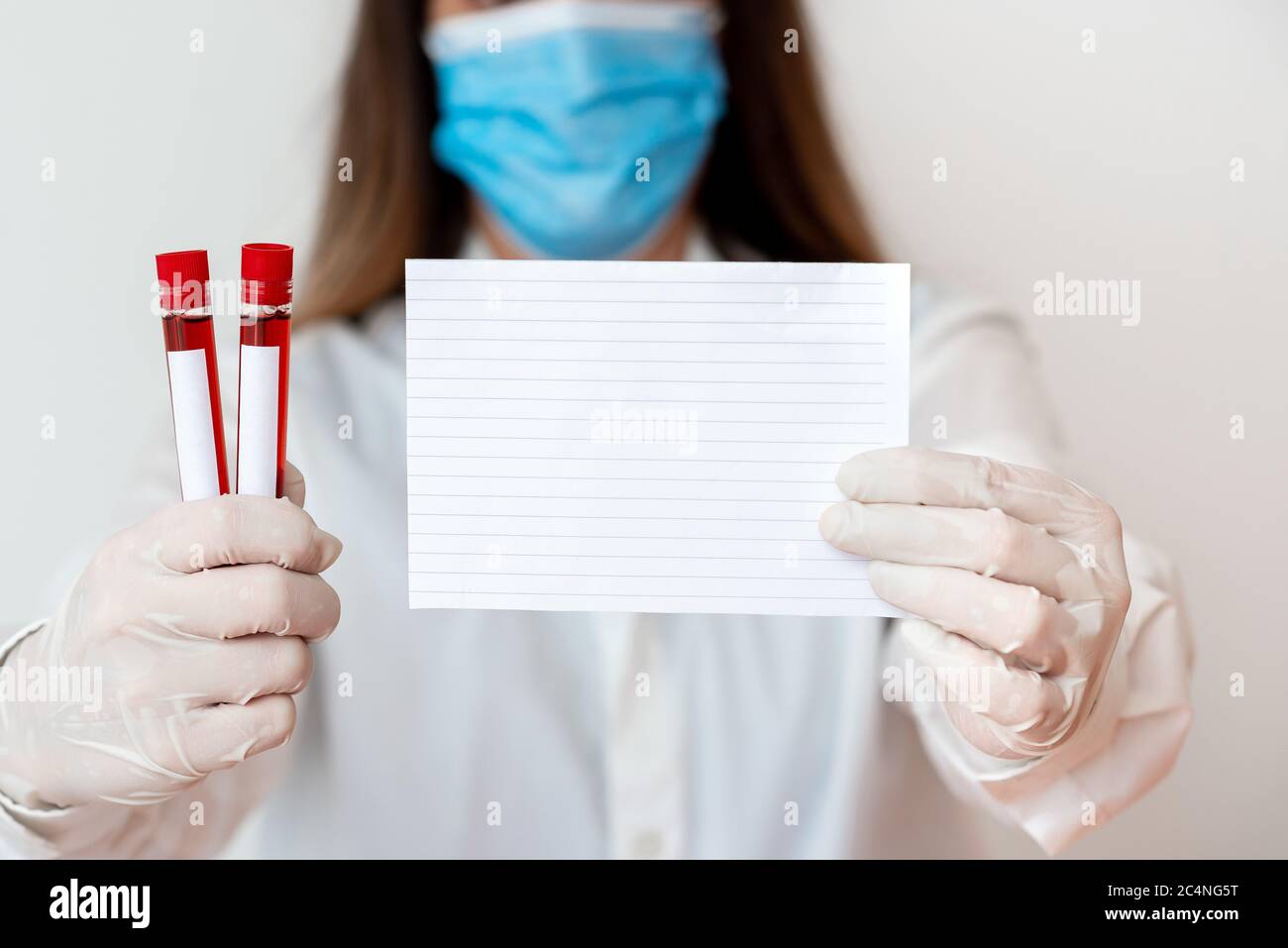 Laboratory Blood Test Sample Shown For Medical Diagnostic Analysis ...