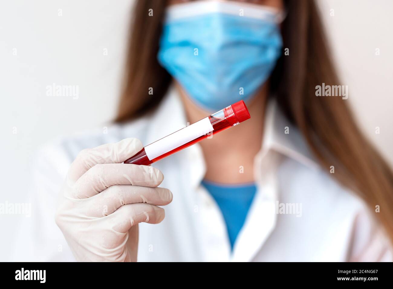 Laboratory Blood Test Sample Shown For Medical Diagnostic Analysis ...