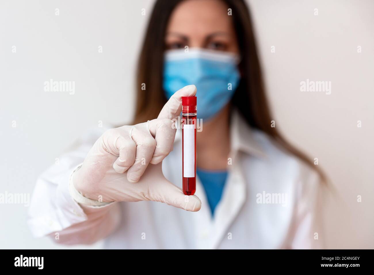 Laboratory Blood Test Sample Shown For Medical Diagnostic Analysis ...