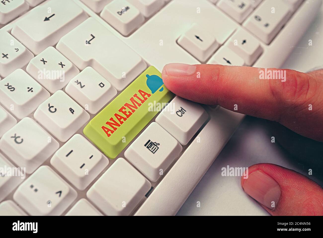 Handwriting text Anaemia. Conceptual photo a condition marked by a ...