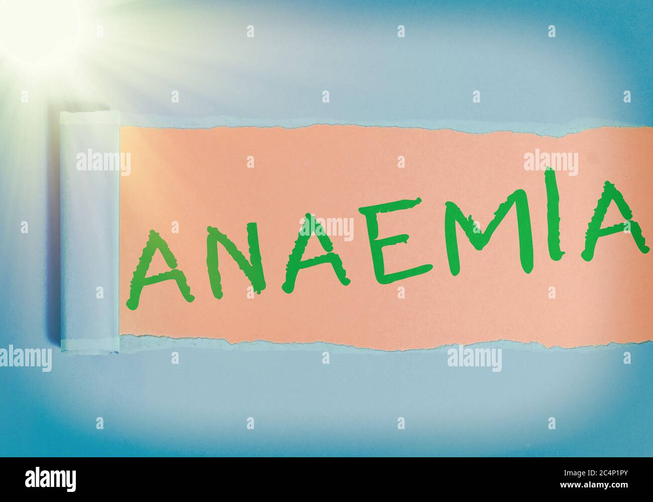 Handwriting text writing Anaemia. Conceptual photo a condition marked ...