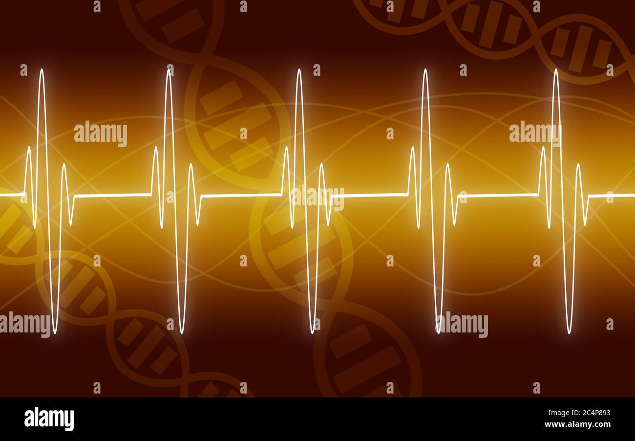 EKG trace on yellow background,3D rendering Stock Photo - Alamy