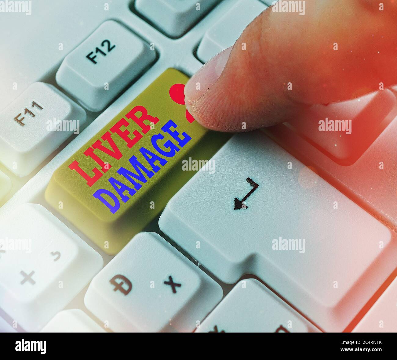 Handwriting text Liver Damage. Conceptual photo any disorder of the ...