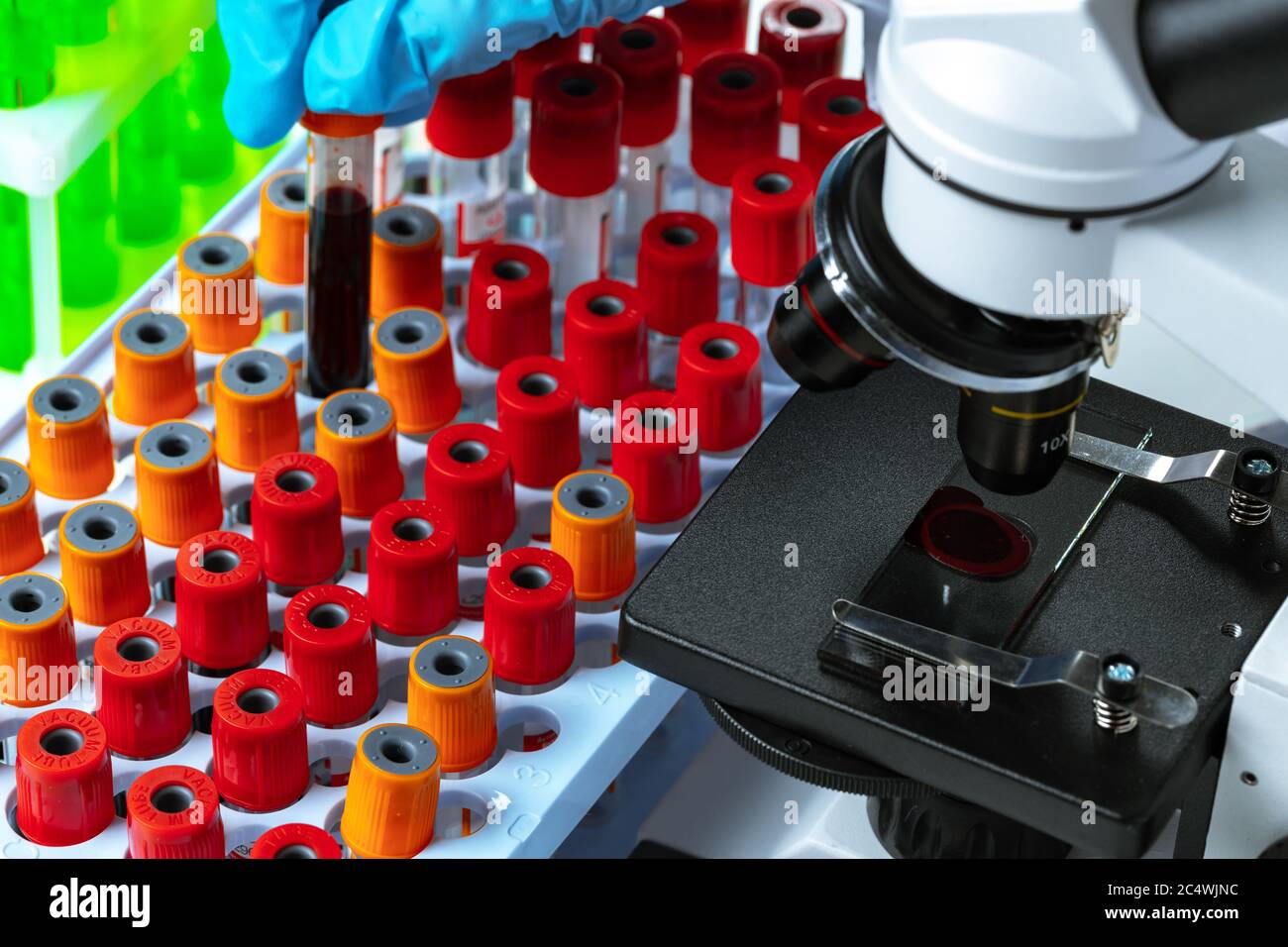 Doctor doing blood test microscope hi-res stock photography and images ...