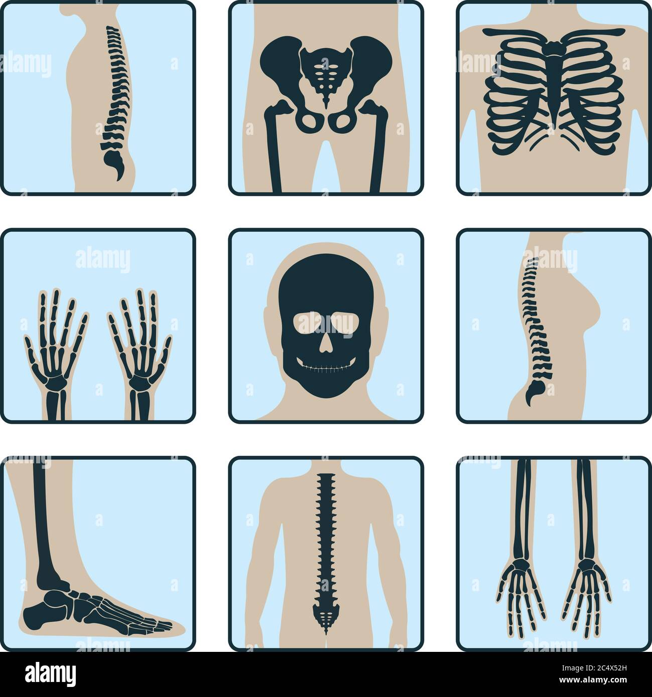 Set of bone, chest x-ray concept icon, roentgen human body image ...