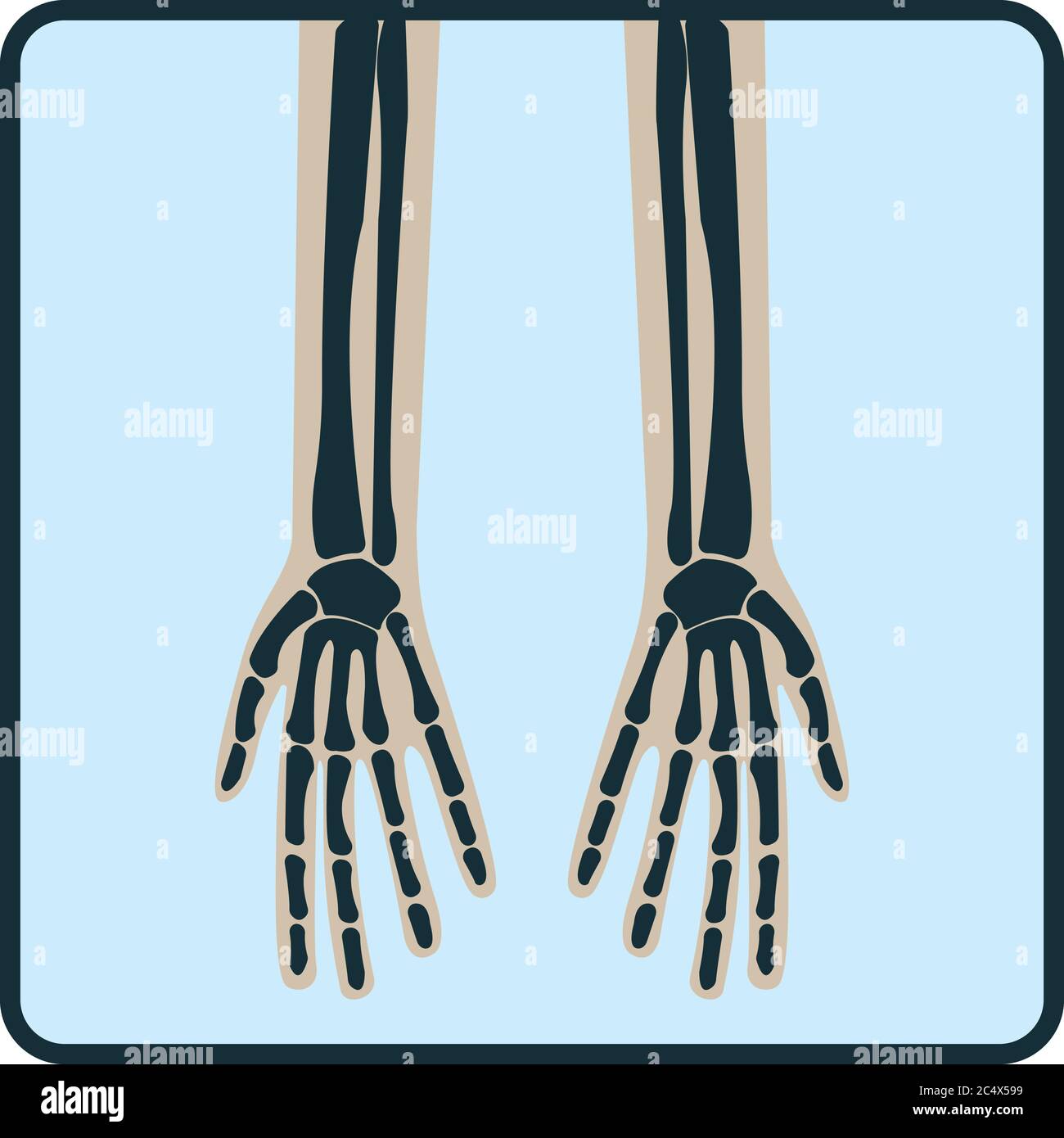 Skeleton Arm And Hand Drawing