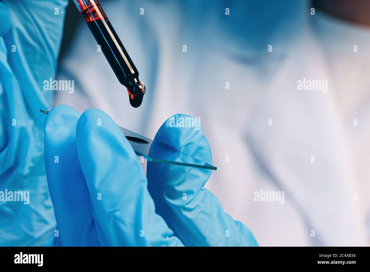 Hands of a laboratory worker doing blood test Stock Photo - Alamy