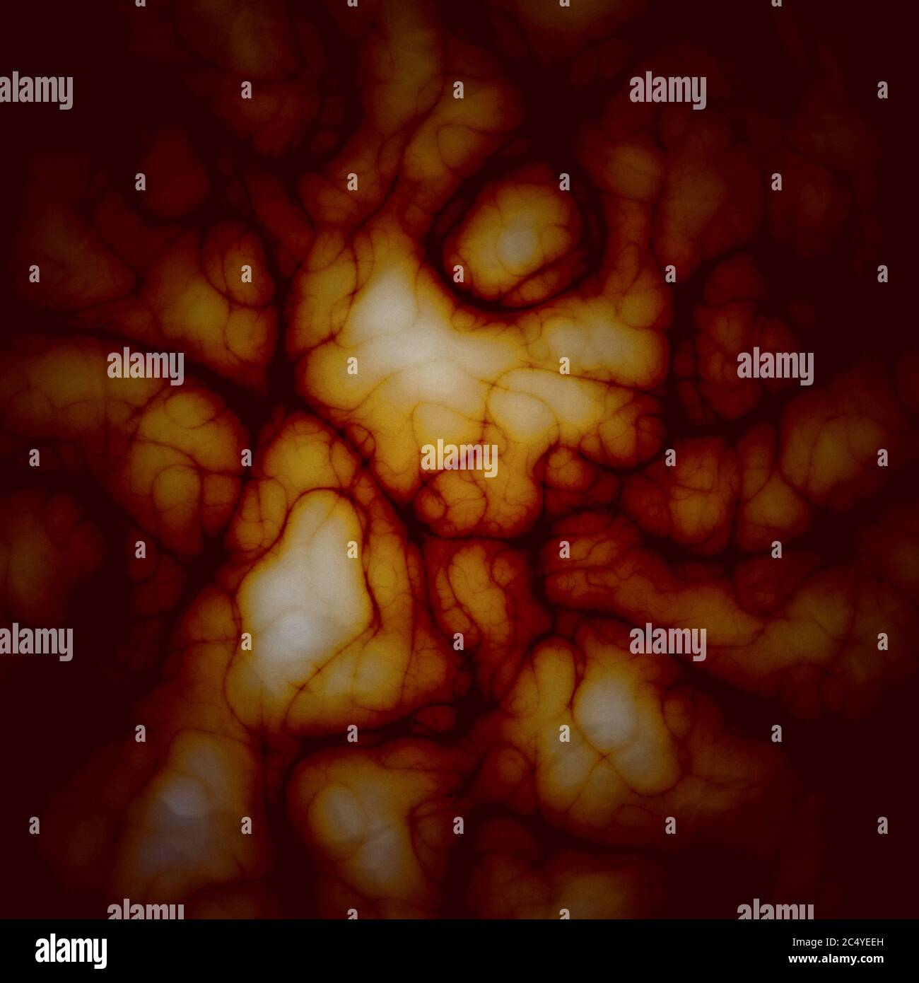 Bloody vessel hi-res stock photography and images - Alamy