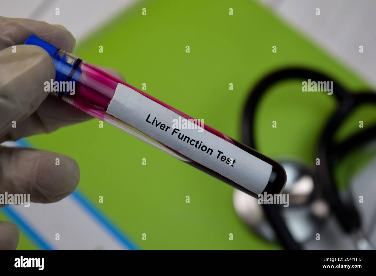 Liver Function Test text with blood sample. Top view isolated on black ...