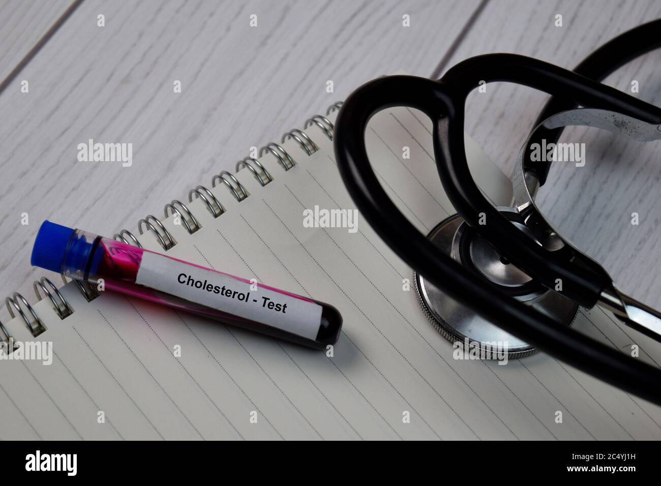 Cholesterol Test text with blood sample. Top view isolated on black ...