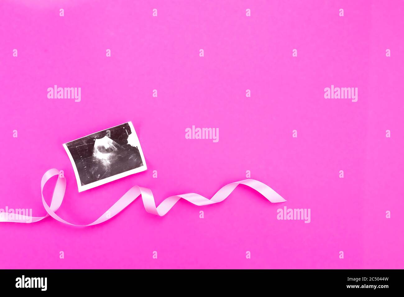 Ultrasound image of a baby with a pink ribbon on a pink background with ...