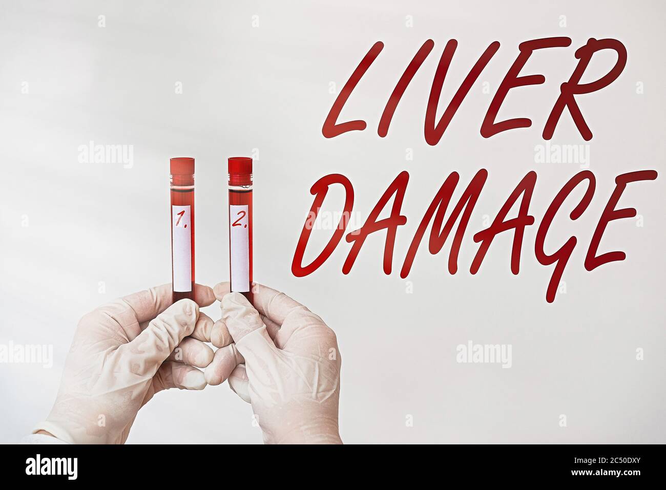 Text sign showing Liver Damage. Business photo text any disorder of the ...