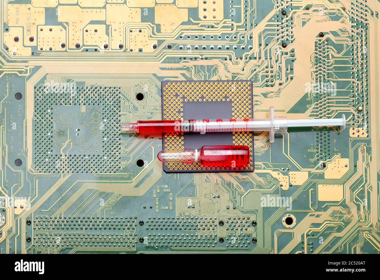 Neural network technology and artificial intelligence implantation ...
