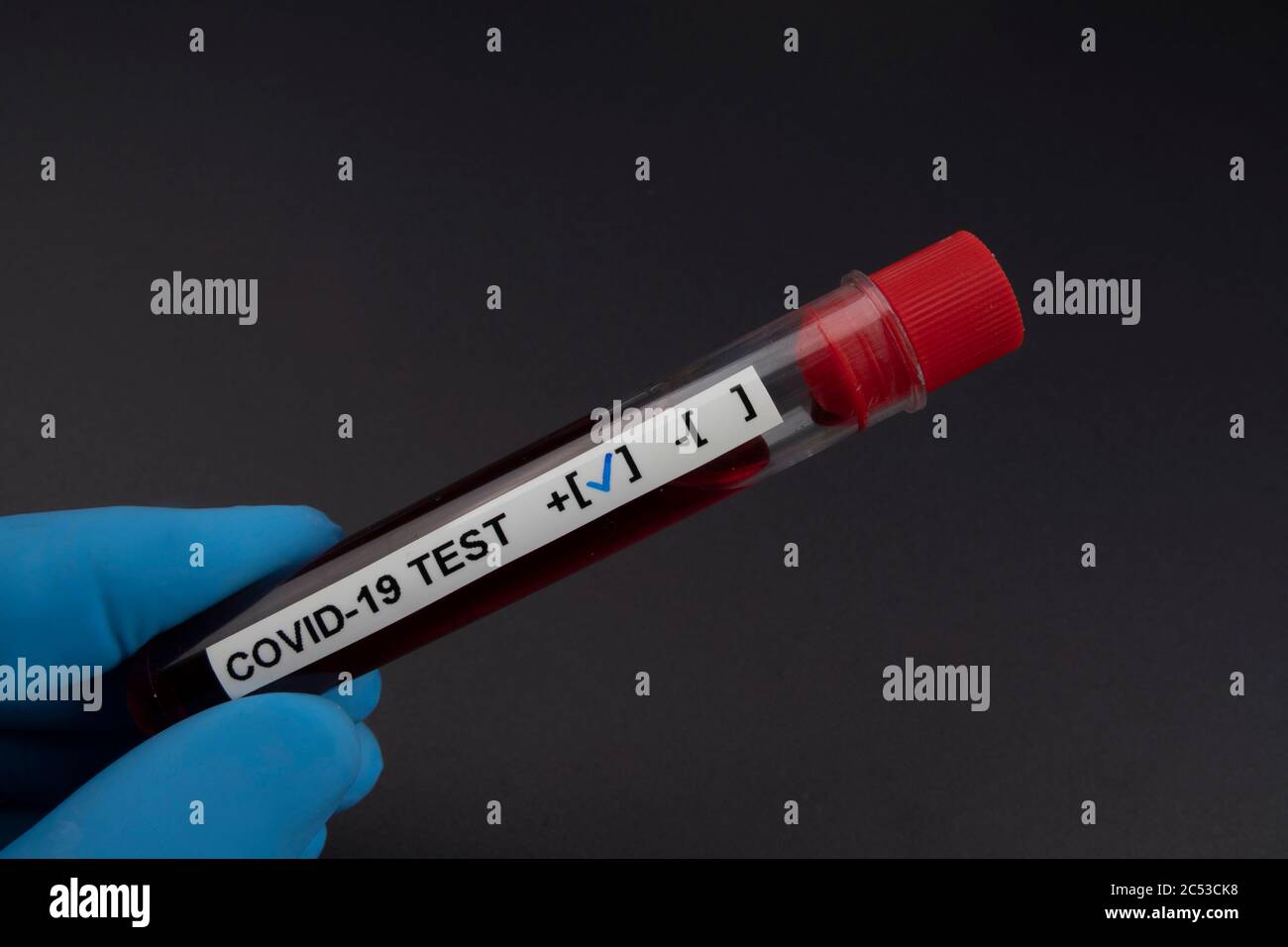 Laboratorian's hand is showing positive result covid-19 test tube in ...