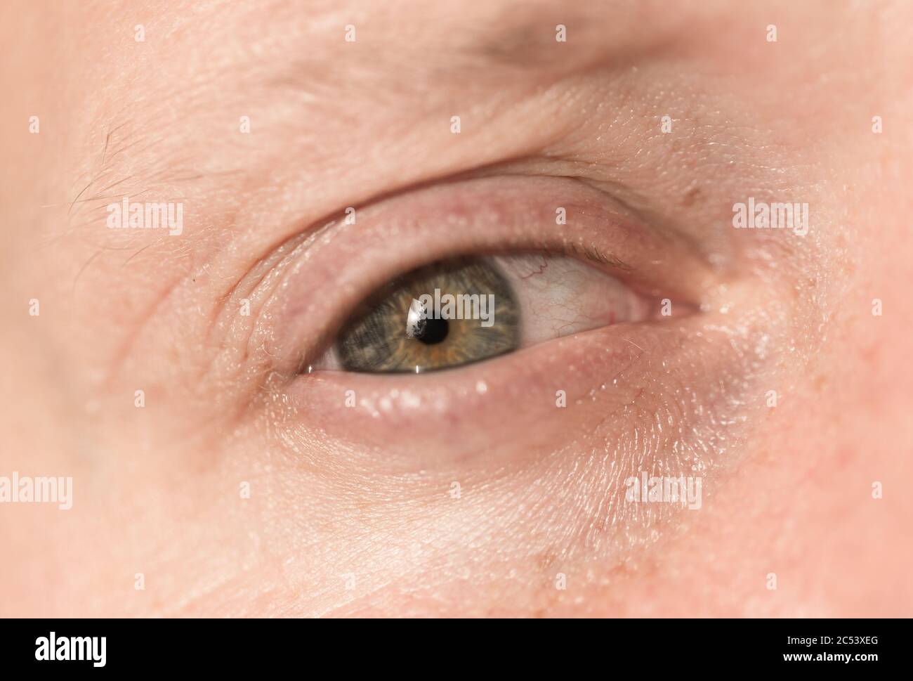 Eyelid Anatomy High Resolution Stock Photography and Images - Alamy