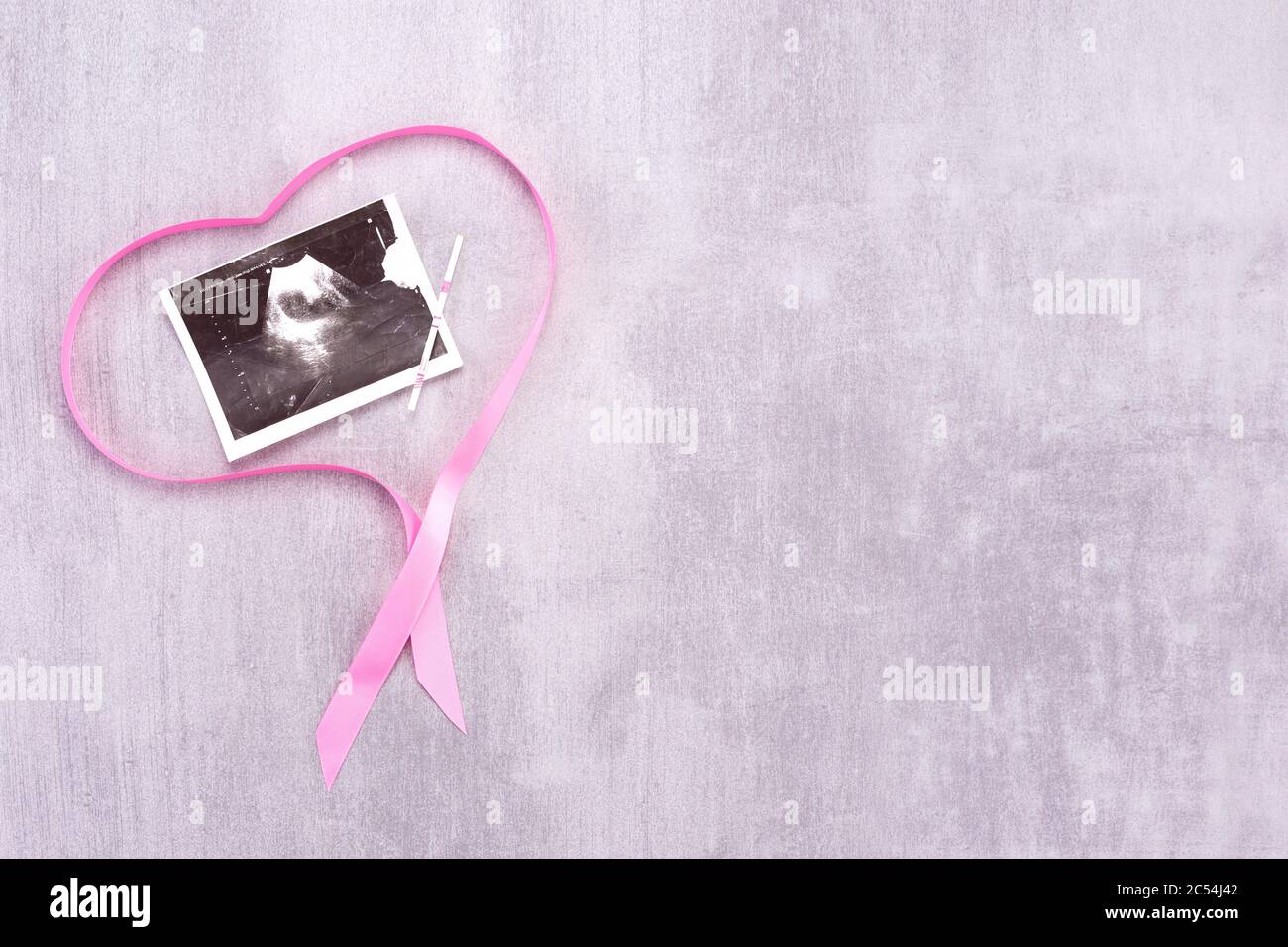 Ultrasound image of a baby with a pink ribbon in the form of a heart on ...