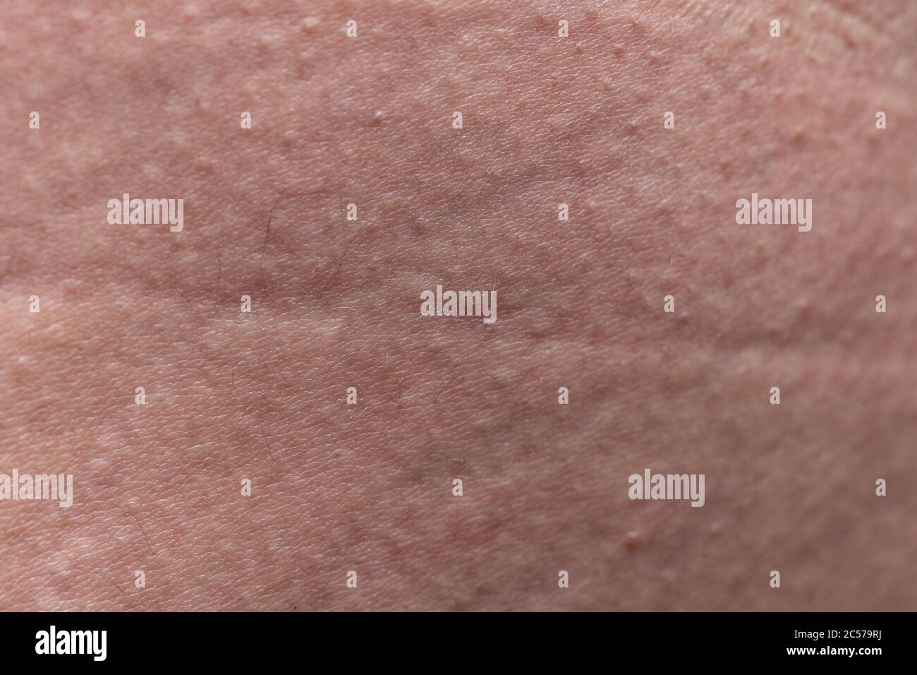 Stretch marks hi-res stock photography and images - Alamy