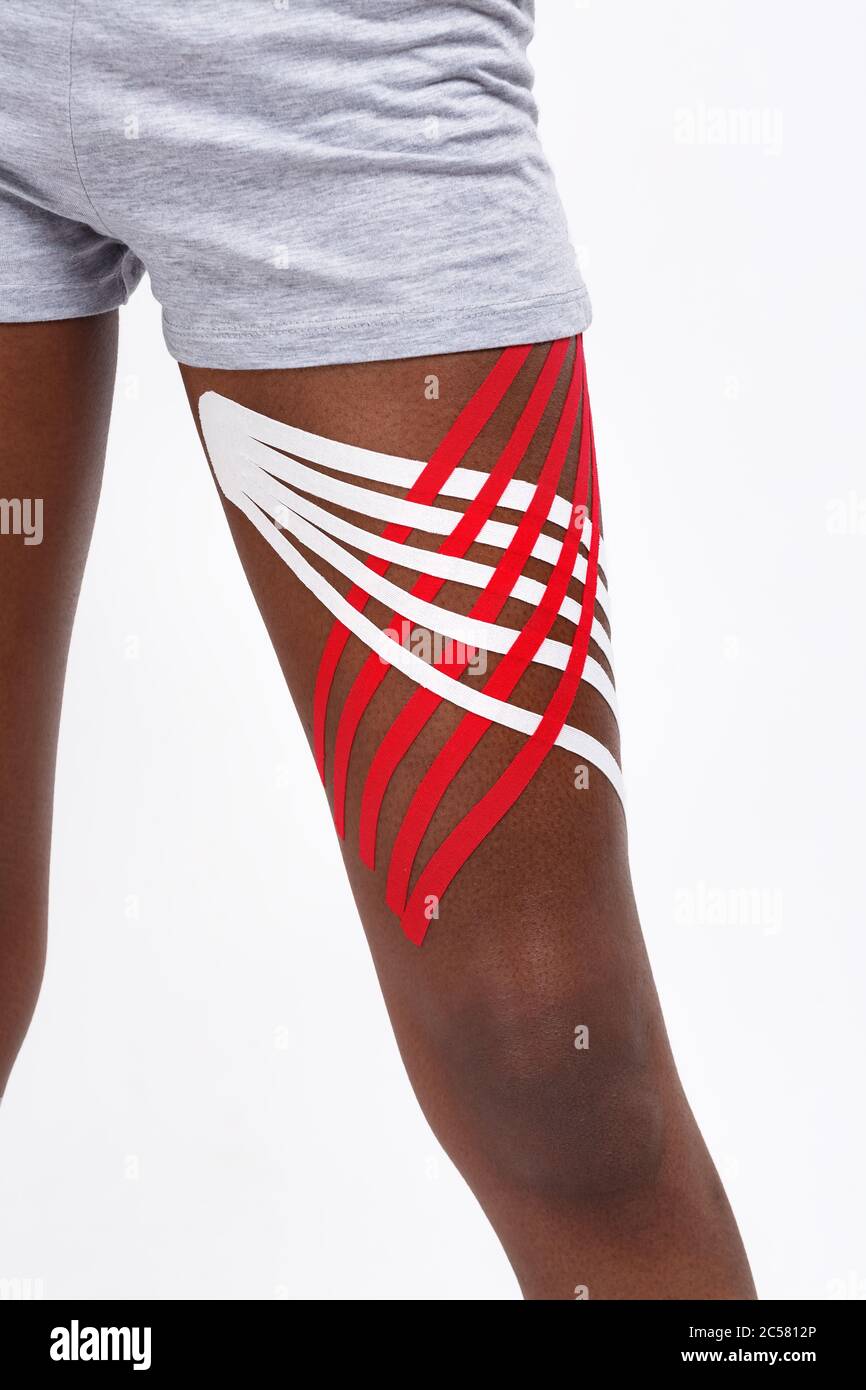 Close up view of kinesiology tape on patient hip.Kinesiology taping ...