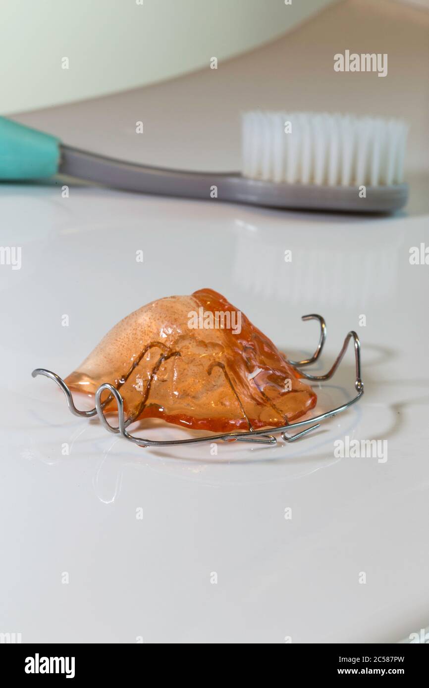 Hawley bow orthodontic teeth retainer still life Stock Photo - Alamy