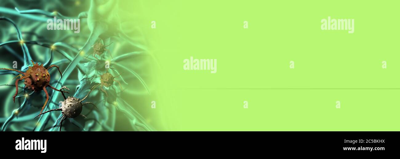 Digital 3d illustration of cancer cells in human body Stock Photo - Alamy
