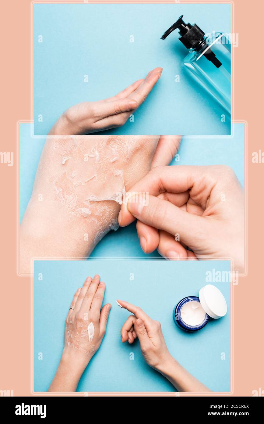 collage of female hand near sanizer, woman peeling off exfoliated skin ...