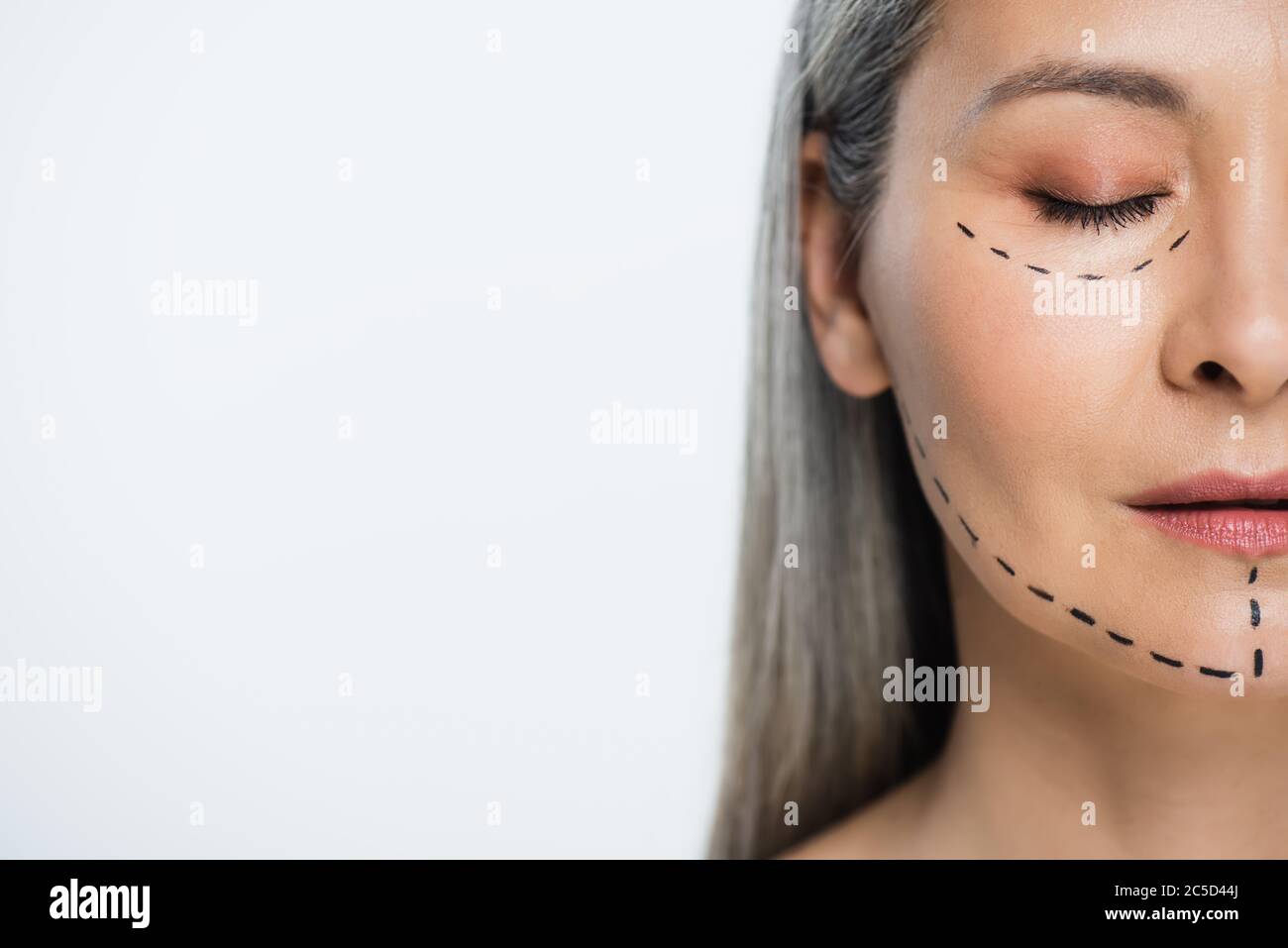 half view of face of asian woman with plastic surgery lines isolated on ...