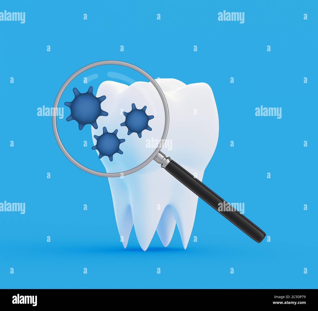 Stages of tooth decay hi-res stock photography and images - Alamy