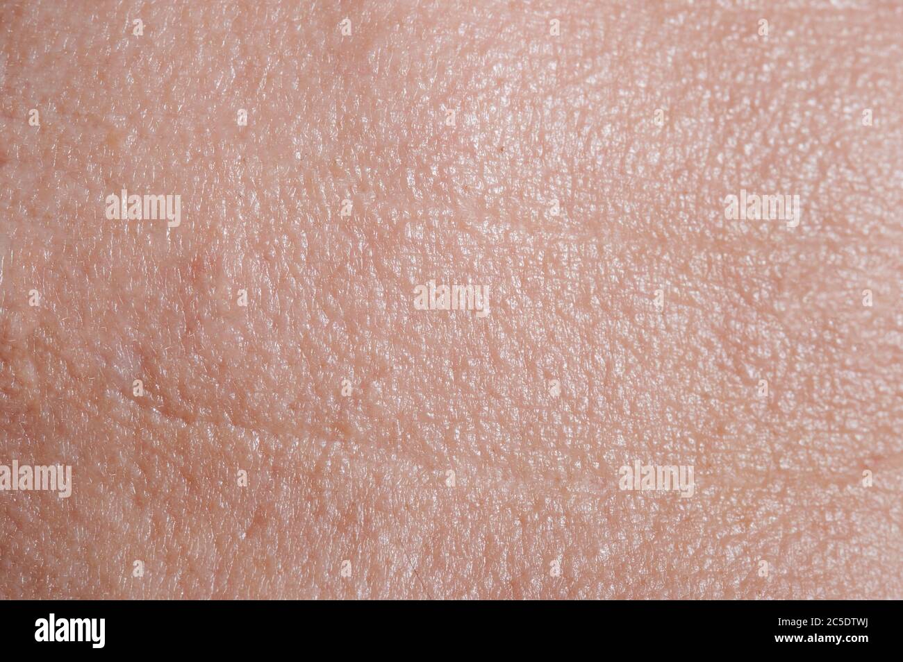 Skin on forehead with wrinkles macro close up view Stock Photo - Alamy
