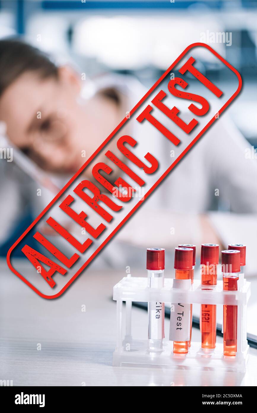 selective focus of glass test tube with lettering near allergist ...