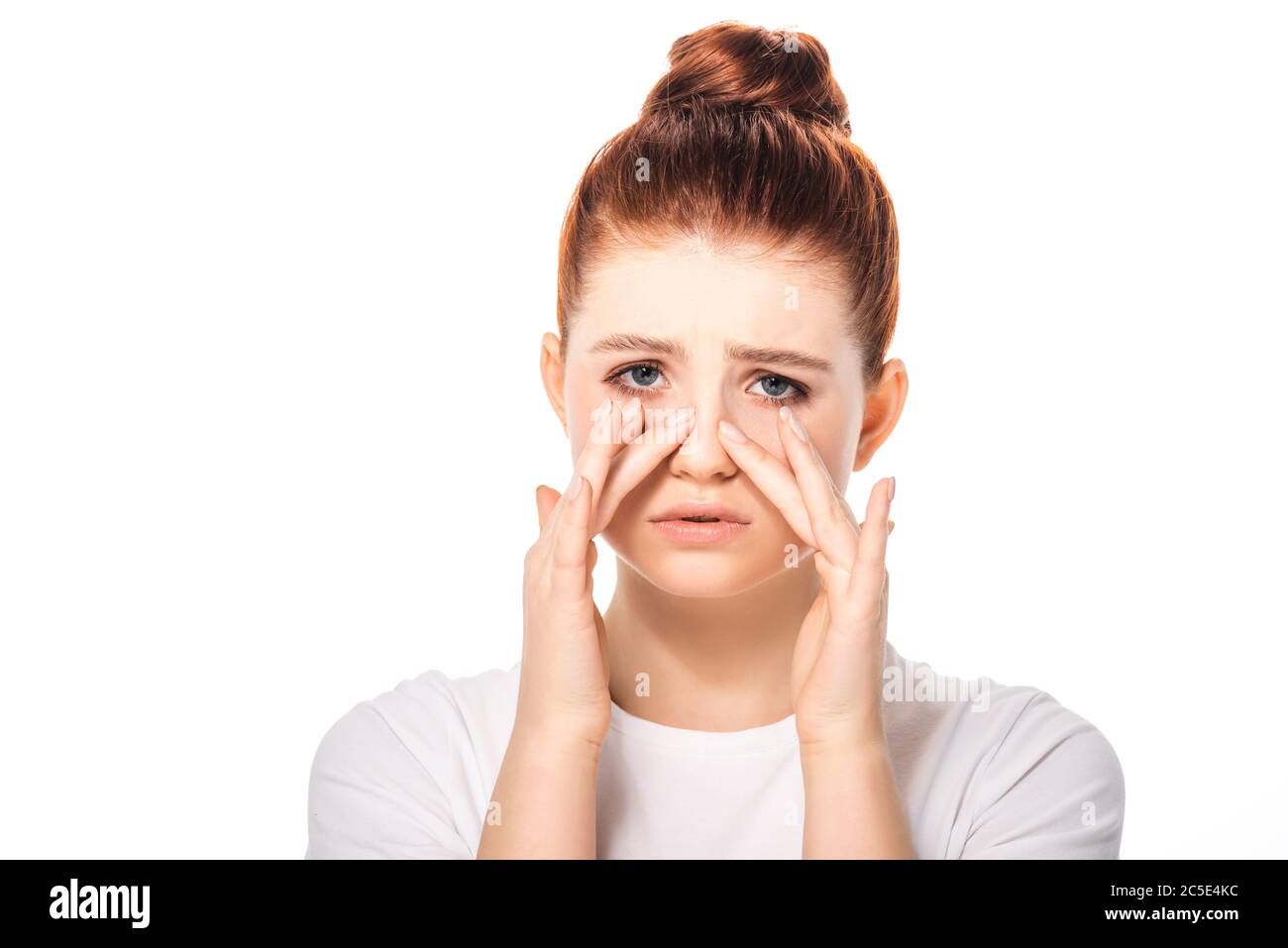 Teen skin problem hi-res stock photography and images - Alamy