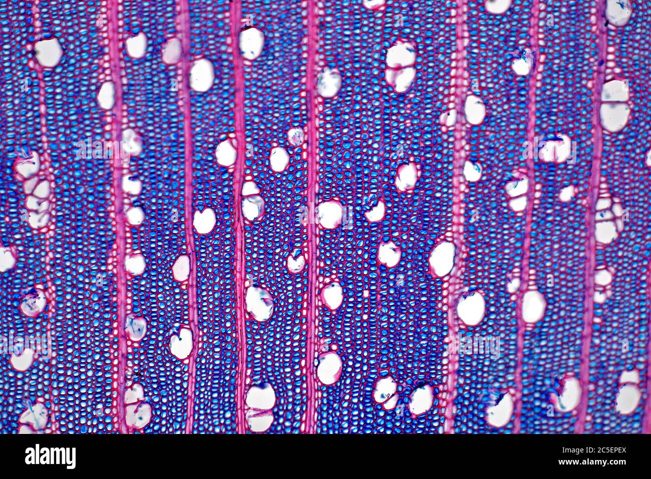 Brightfield photomicrograph, Devils walking stick tree, Aralia spinosa ...