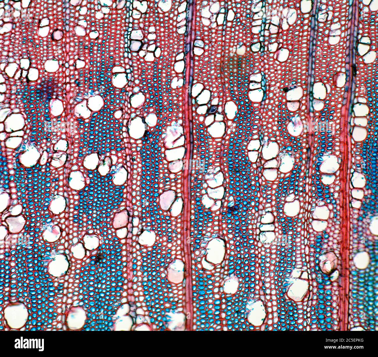 Brightfield photomicrograph, Devils walking stick tree, Aralia spinosa ...