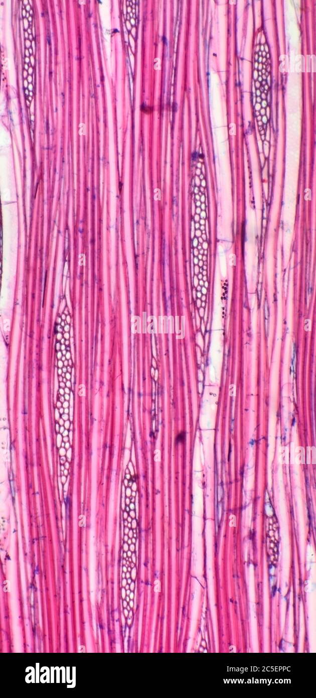 Plant cell structure micrograph hi-res stock photography and images - Alamy