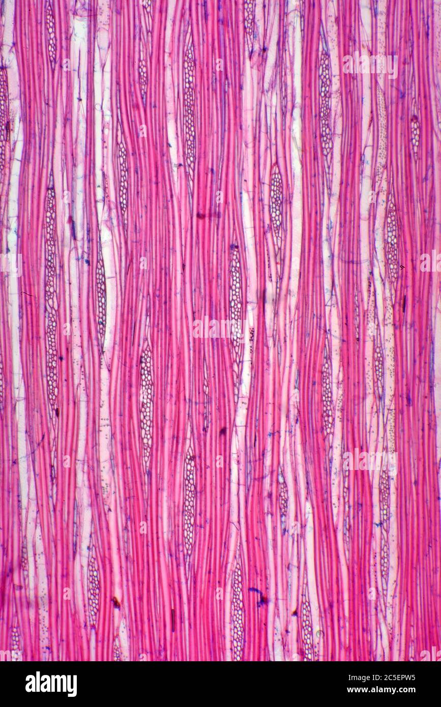 Brightfield photomicrograph, Devils walking stick tree, Aralia spinosa ...