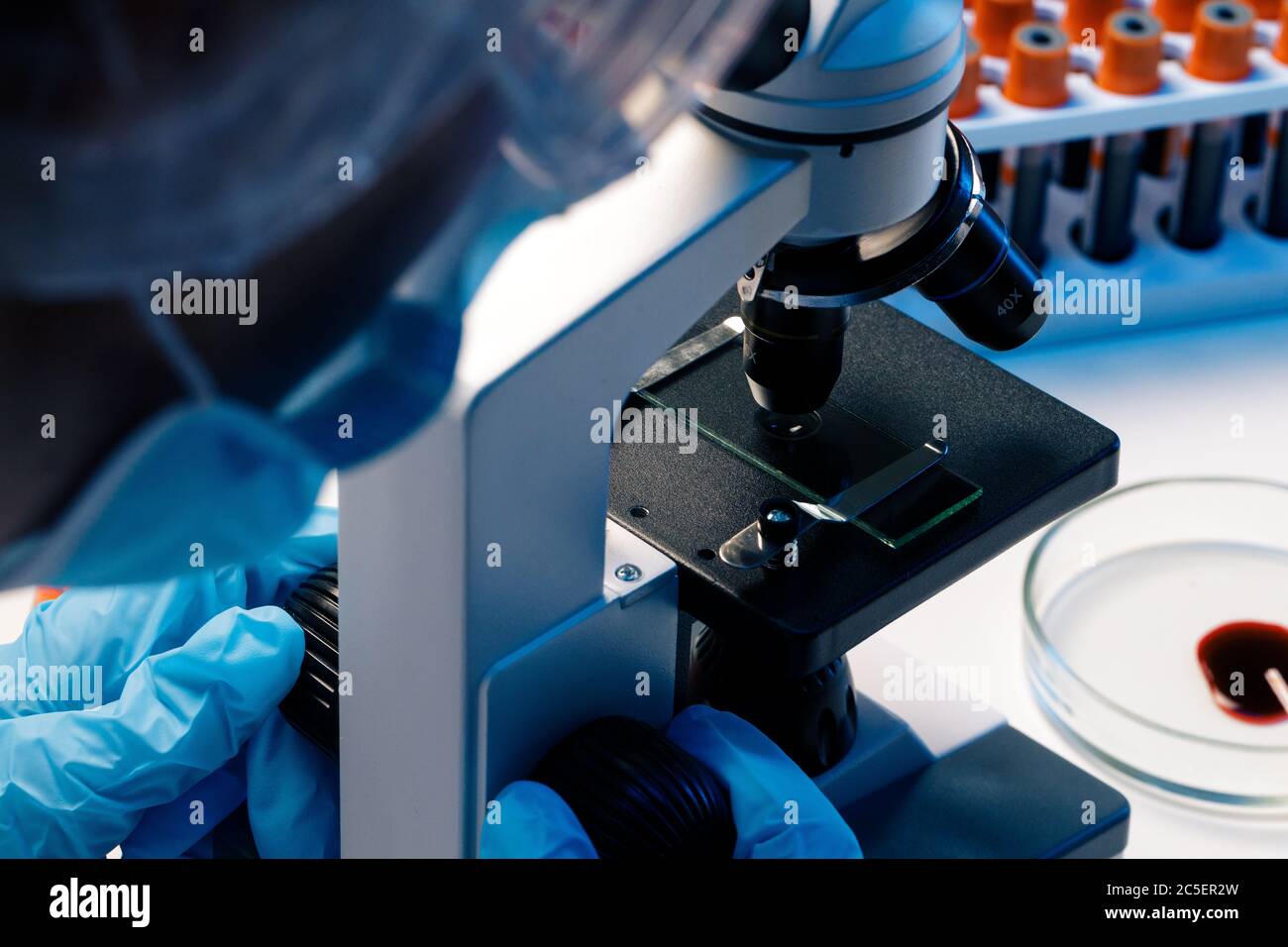 Hands of a laboratory worker doing blood test Stock Photo - Alamy