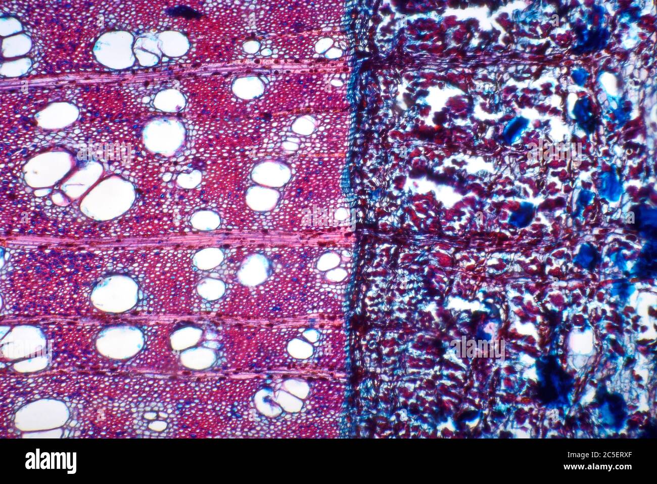 English Elm, root section, Ulmus procera, brightfield photomicrograph ...