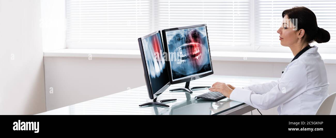 Dentist Doctor Looking At Teeth Xray On Computer Stock Photo - Alamy