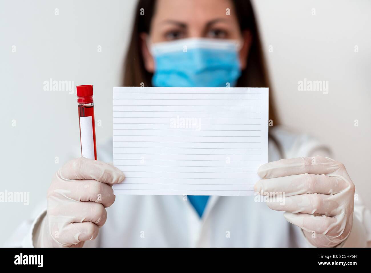 Laboratory Blood Test Sample Shown For Medical Diagnostic Analysis ...