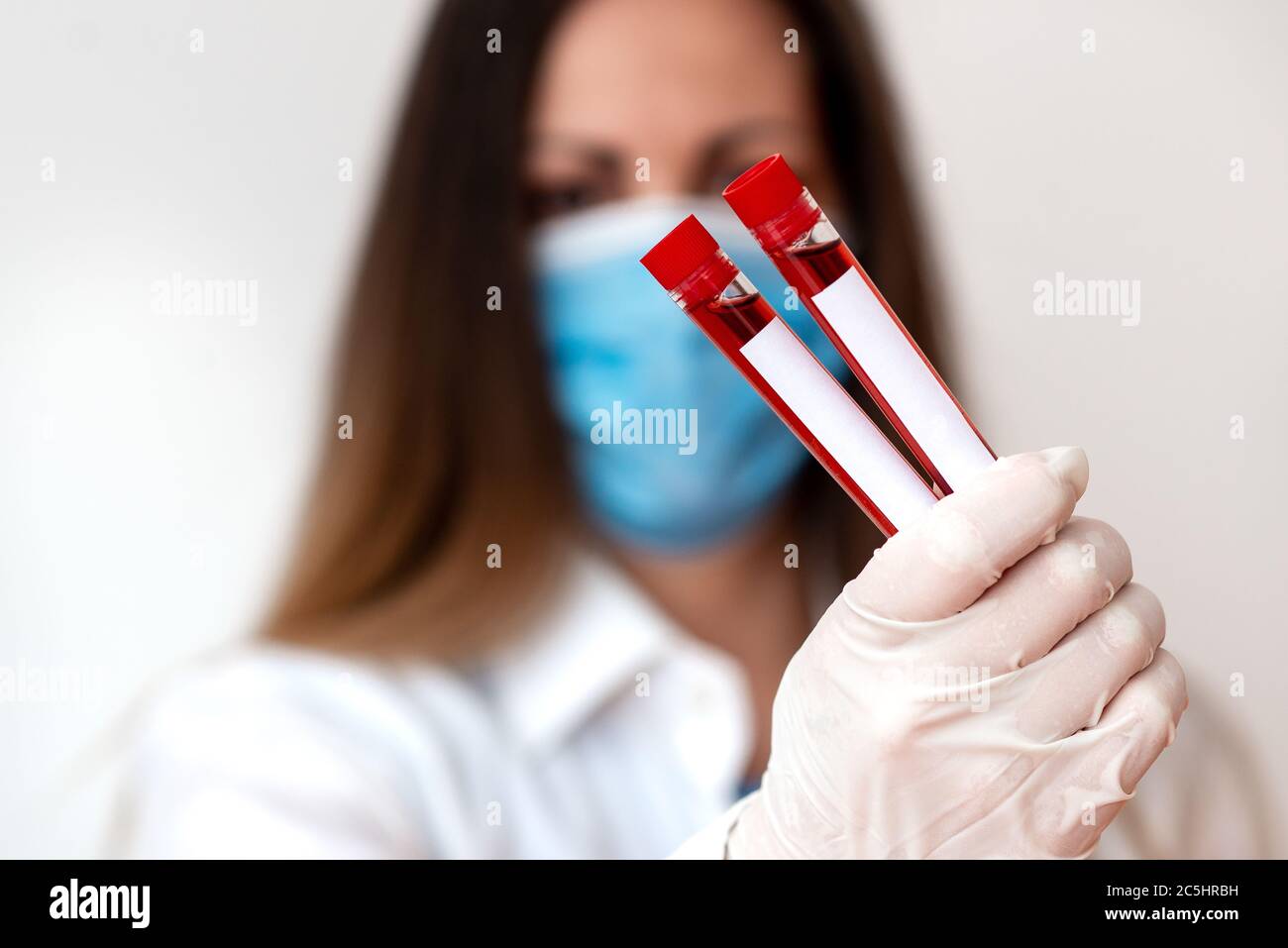 Laboratory Blood Test Sample Shown For Medical Diagnostic Analysis ...