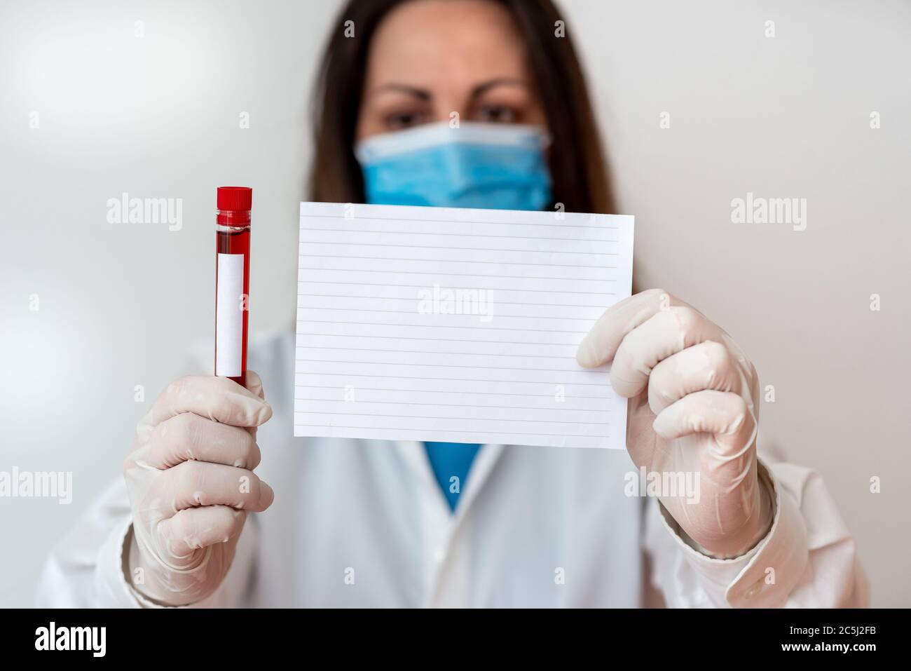 Laboratory Blood Test Sample Shown For Medical Diagnostic Analysis ...
