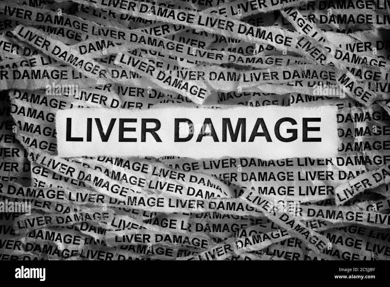 Liver Damage. Torn pieces of paper with the words Liver Damage. Concept ...