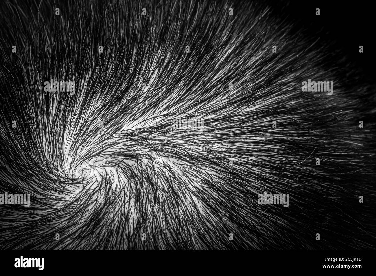 Human skin texture dark hi-res stock photography and images - Alamy